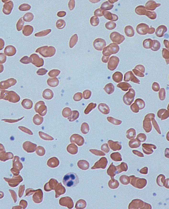 Selection to maintain variation